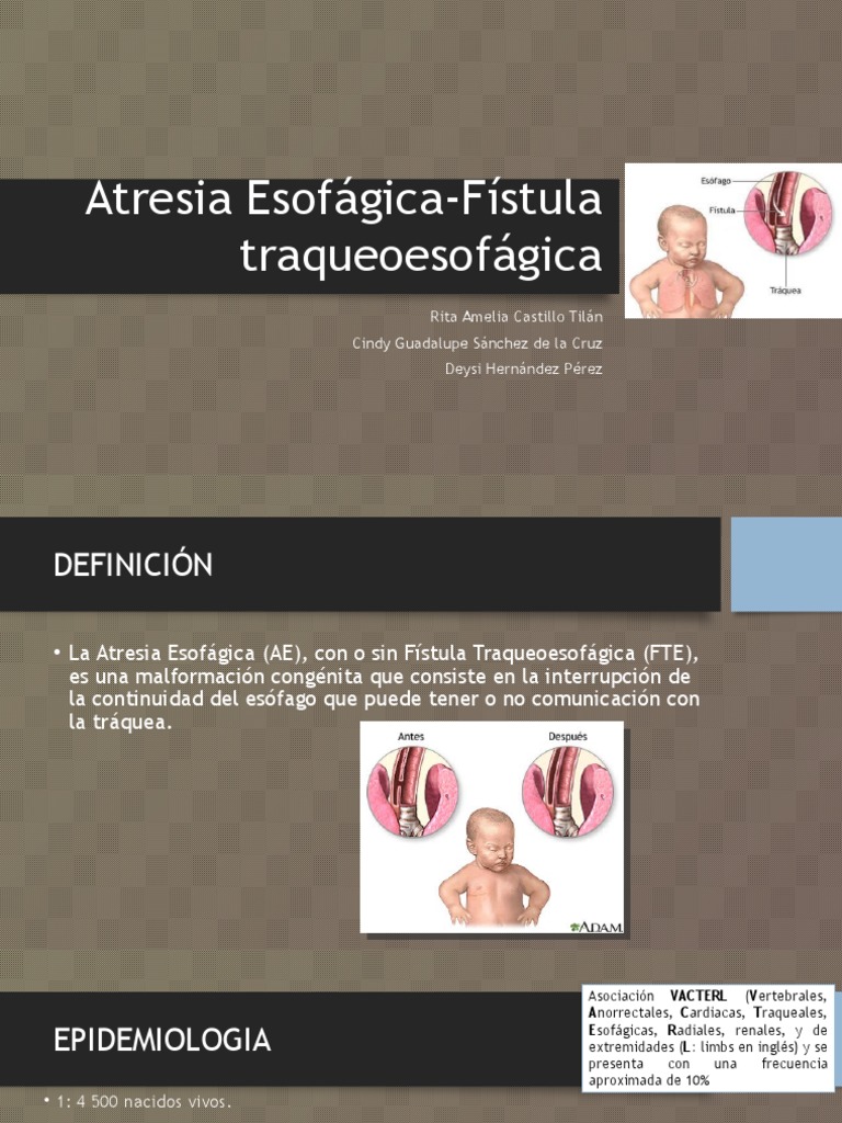 Atresia Esofágica-Fístula Traqueoesofágica | PDF