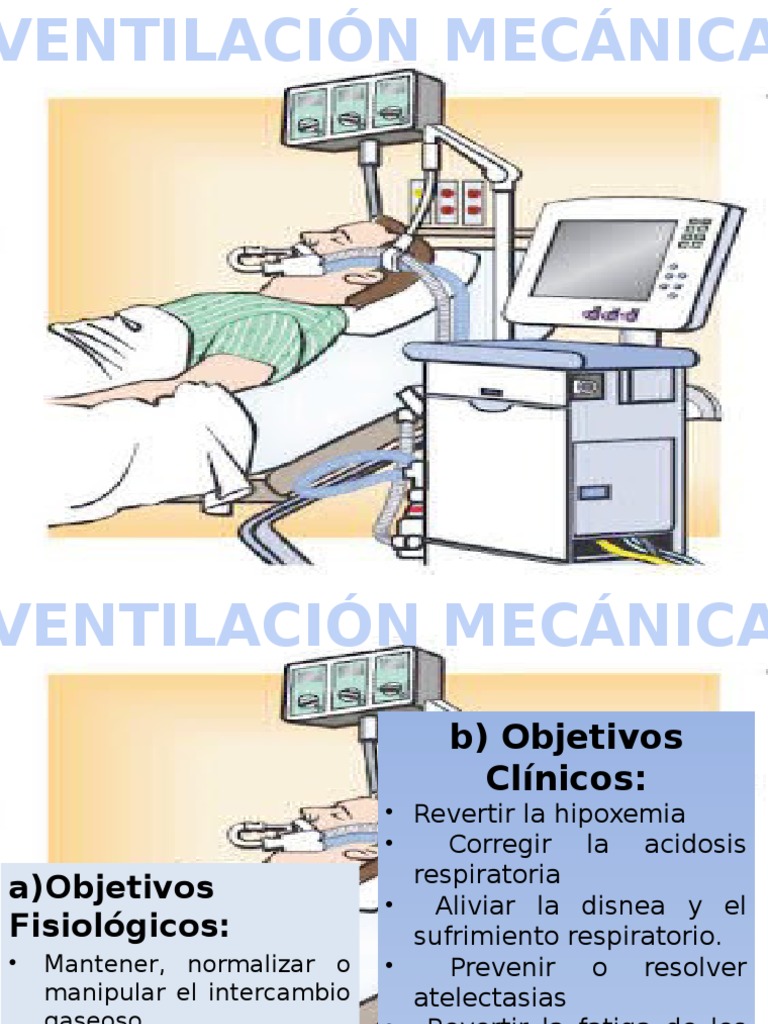 Ventilacion Mecanica | Sistema respiratorio | Respiración