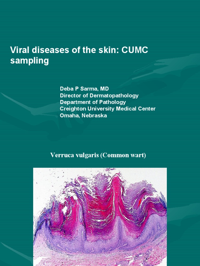 Viral Skin Diseases Overview | PDF