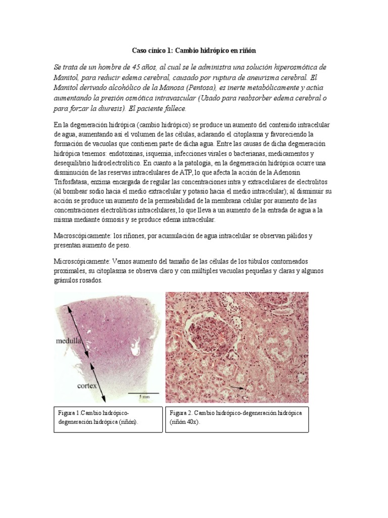 Anatomia Patologica. Casos Clinicos | PDF | Anatomía | Especialidades ...
