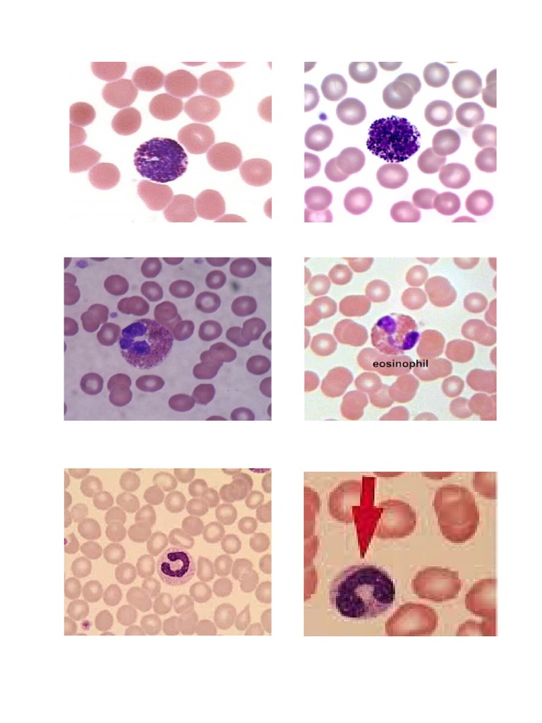 Hitung Jenis Leukosit (Basofil Esonofil Batang) | PDF