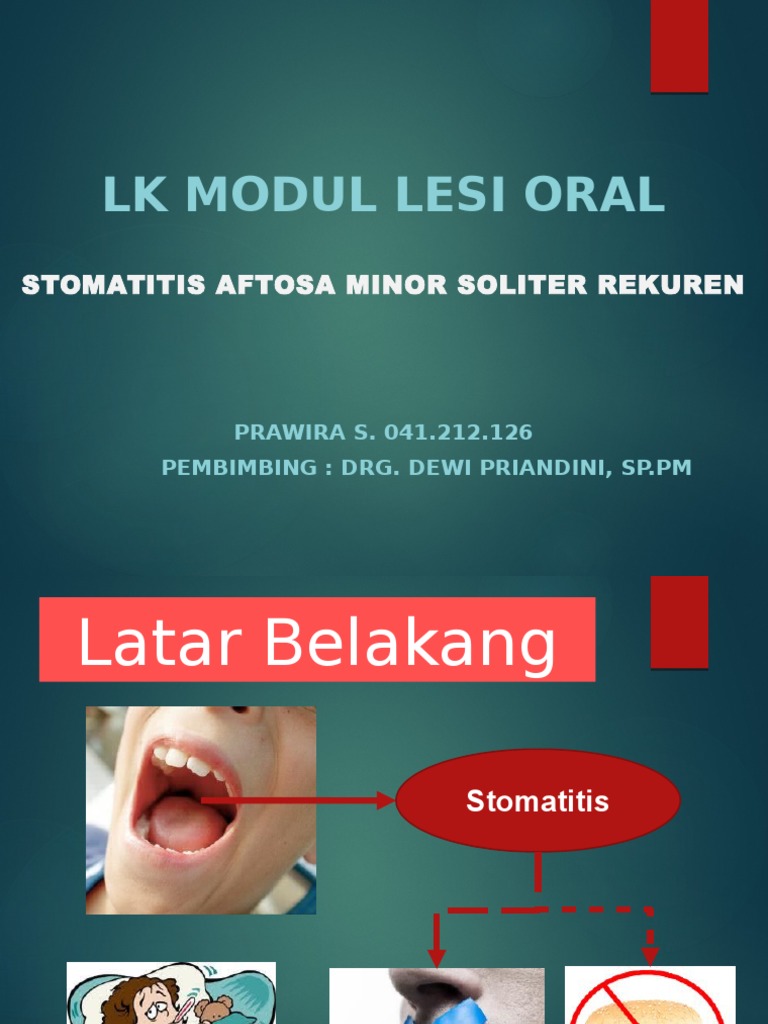 LK OM 2 (Stomatitis Aftosa Minor) | PDF