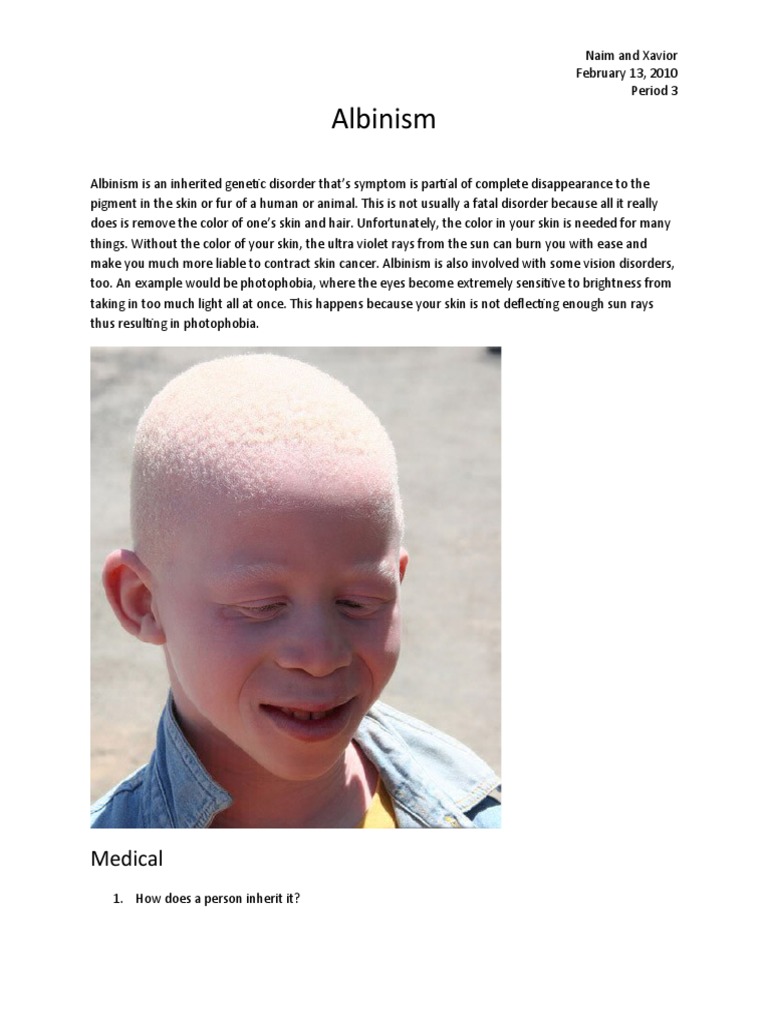 Albinism | Download Free PDF | Clinical Medicine | Diseases And Disorders