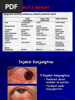 Beda Injeksi Konjungtiva Dan Siliar | PDF | Ilmu Sosial