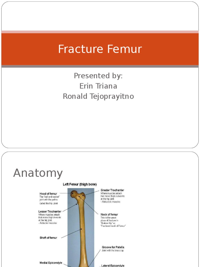 Fracture Femur | Musculoskeletal System | Lower Limb Anatomy