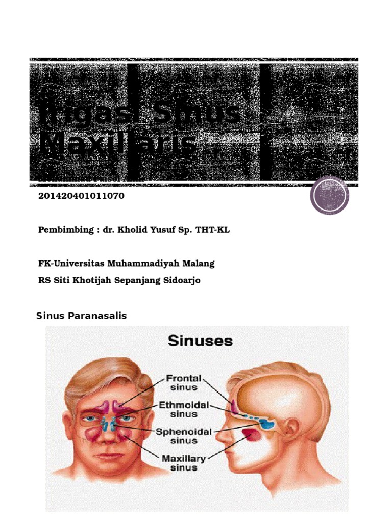 Irigasi Sinus Maxillaris New | PDF