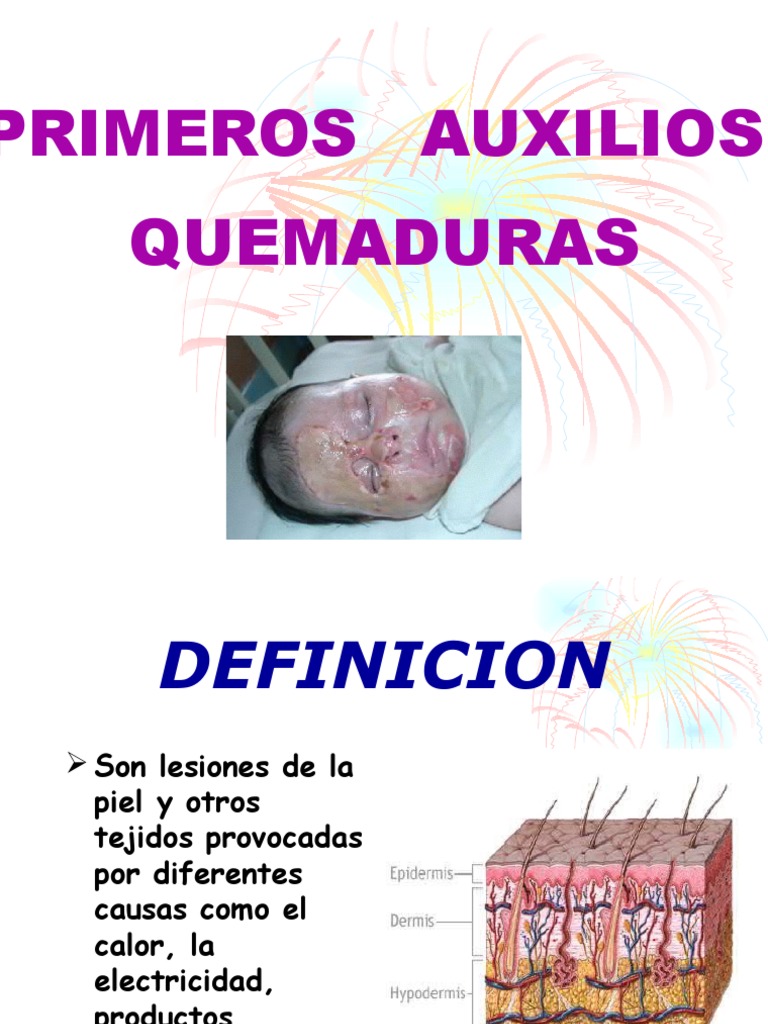 Primeros Auxilios - Quemaduras | PDF | Quemar | Primeros auxilios
