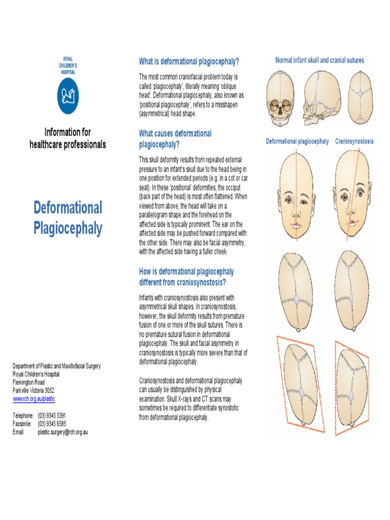 Deformational Plagiocephaly | PDF | Medical Specialties | Diseases And ...
