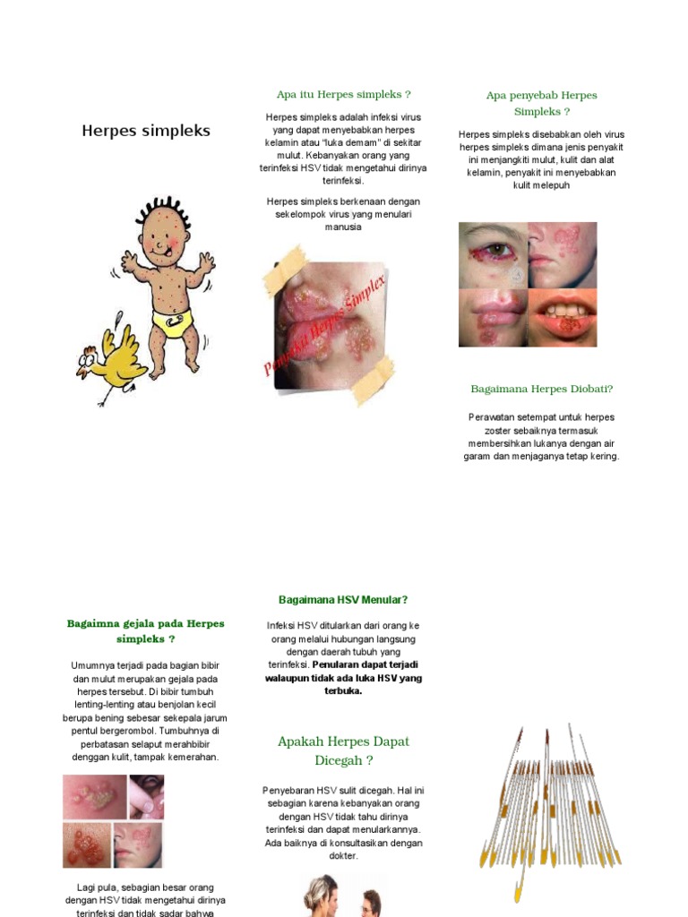 Herpes Simpleks Leaflet | PDF