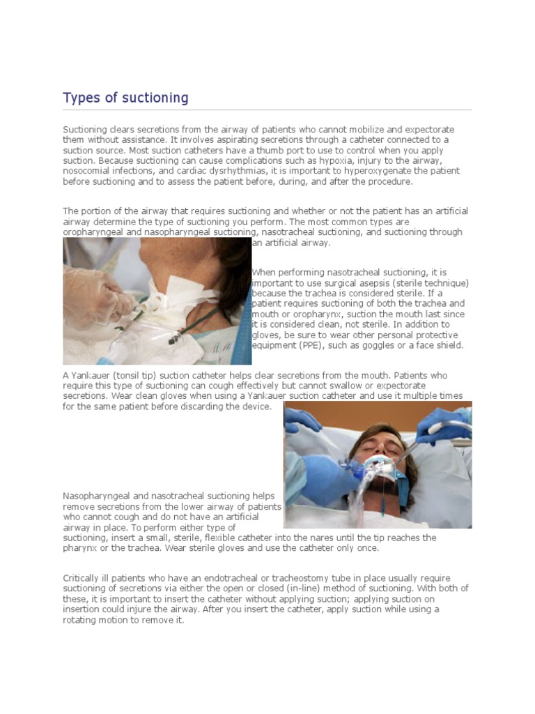 Types of Suctioning | Catheter | Clinical Medicine | Free 30-day Trial ...