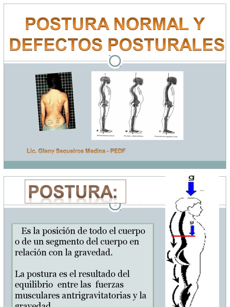 Evaluación de Defectos Posturales | PDF | Pelvis | Rodilla