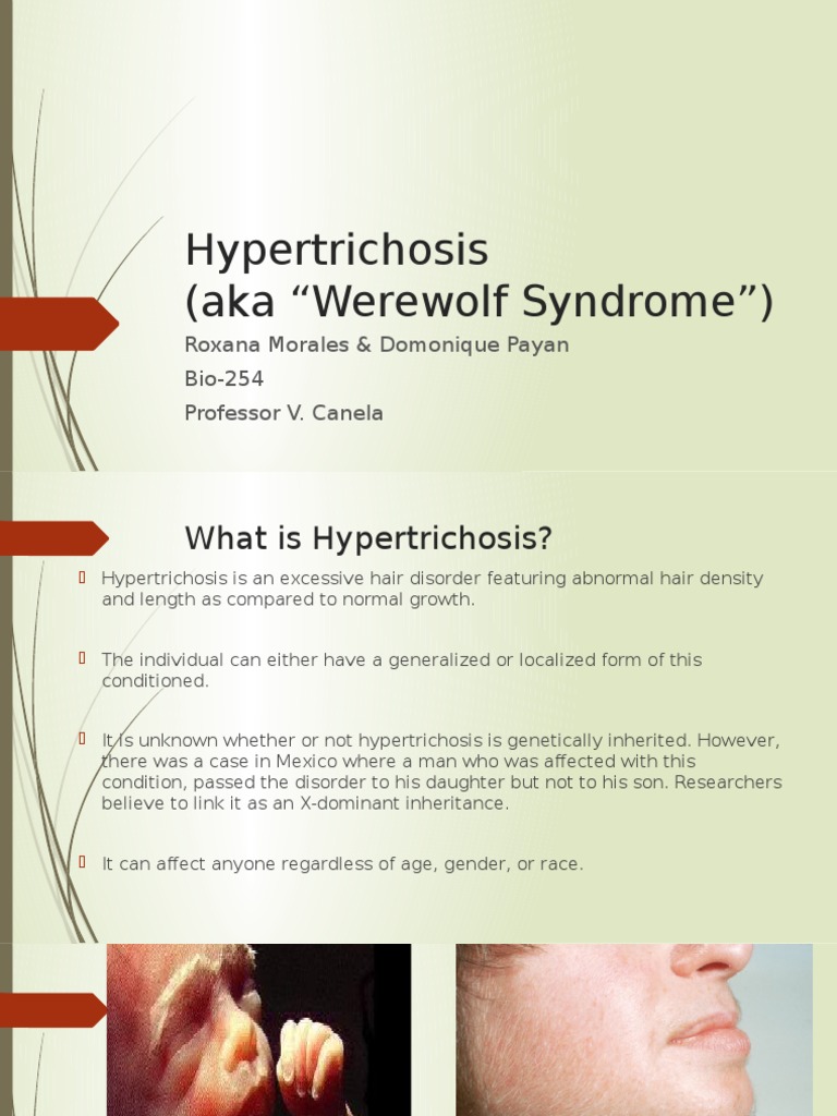 Hypertrichosis: Types, Causes, Treatments | PDF | Diseases And ...