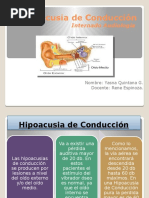 La Barotitis Media | PDF