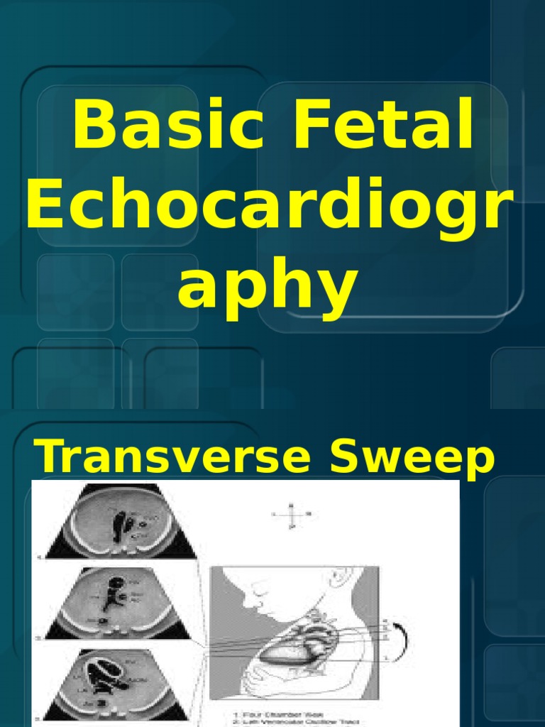 Basic Fetal Echocardiography | PDF | Heart Valve | Atrium (Heart)