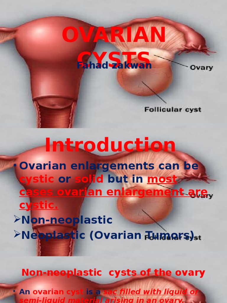 Ovarian Cysts | PDF | Polycystic Ovary Syndrome | Ovarian Cancer