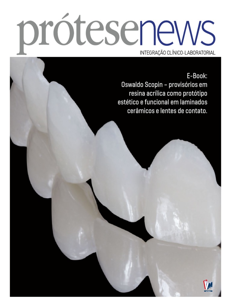 Provisorio Acrilico p Facetas | Dente | Odontologia