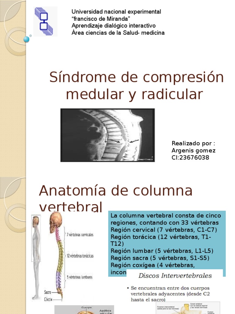 Síndrome de Compresión Medular y Radicular | PDF | Vértebra | Médula espinal