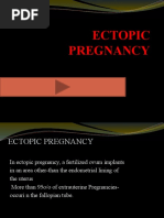 McCall Culdoplasty Procedure Overview | PDF | Vagina | Surgical Specialties
