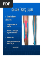 Efeitos do Spiral Taping na Força Manual | PDF | Acupuntura | Remédio