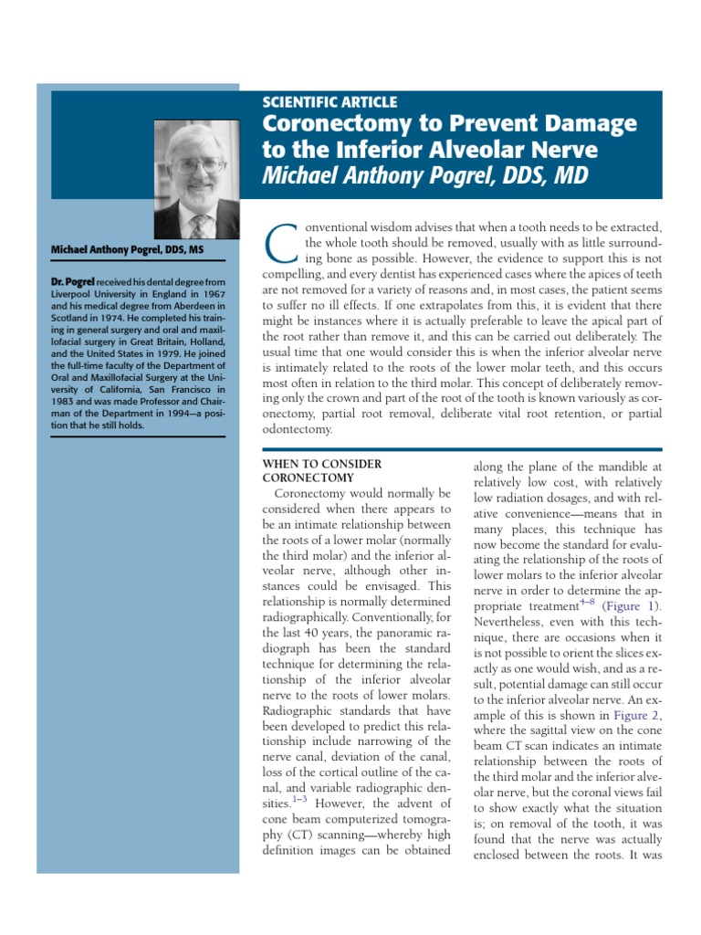 Coronectomy To Prevent Damage | PDF | Human Tooth | Facial Features