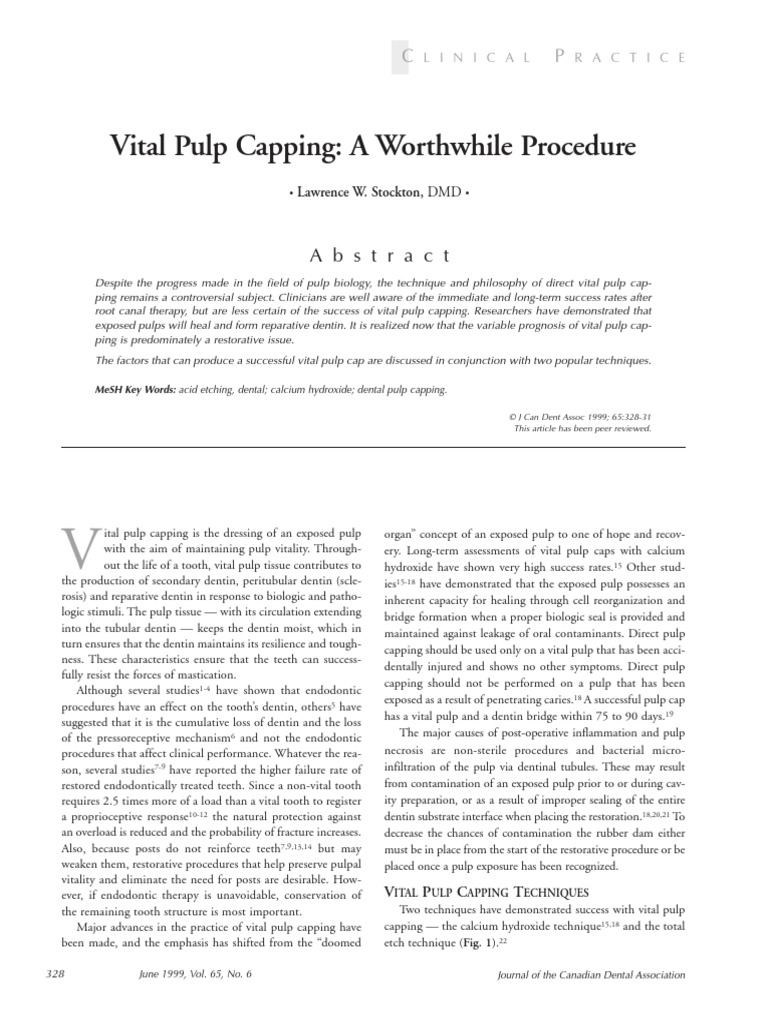 Vital Pulp Capping: A Worthwhile Procedure: Lawrence W. Stockton, DMD ...