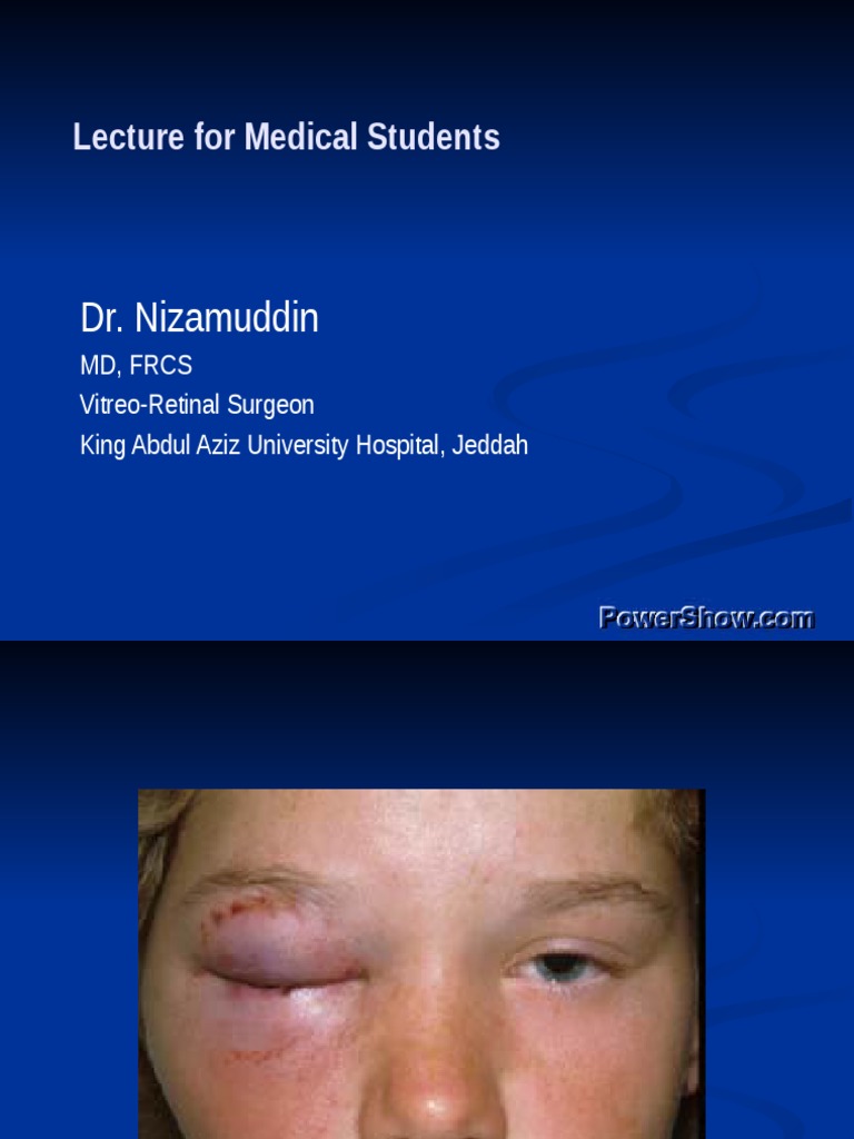 Ocular Injuries by DR Niz 3663922 | PDF | Human Eye | Cornea