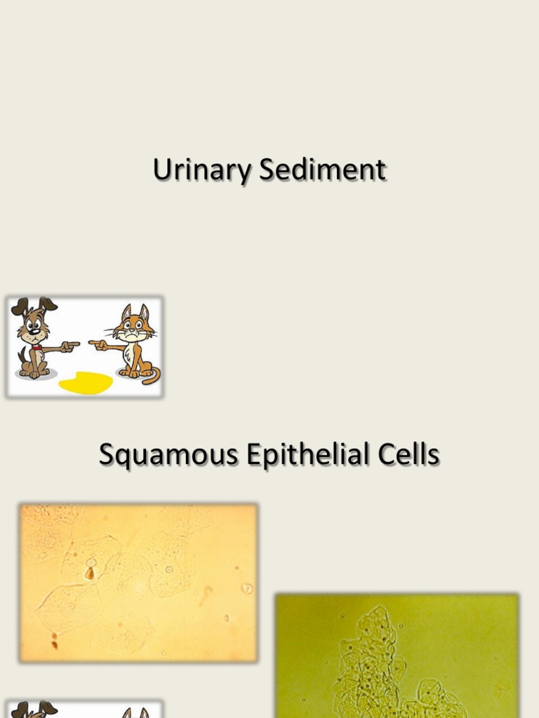 Sedimen Urin | PDF