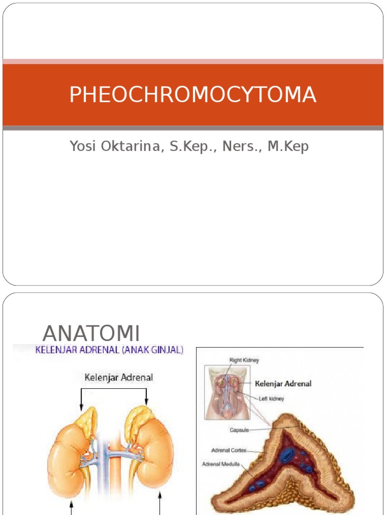 PHEOCHROMOCYTOMA | PDF | Epinephrine | Adrenal Gland