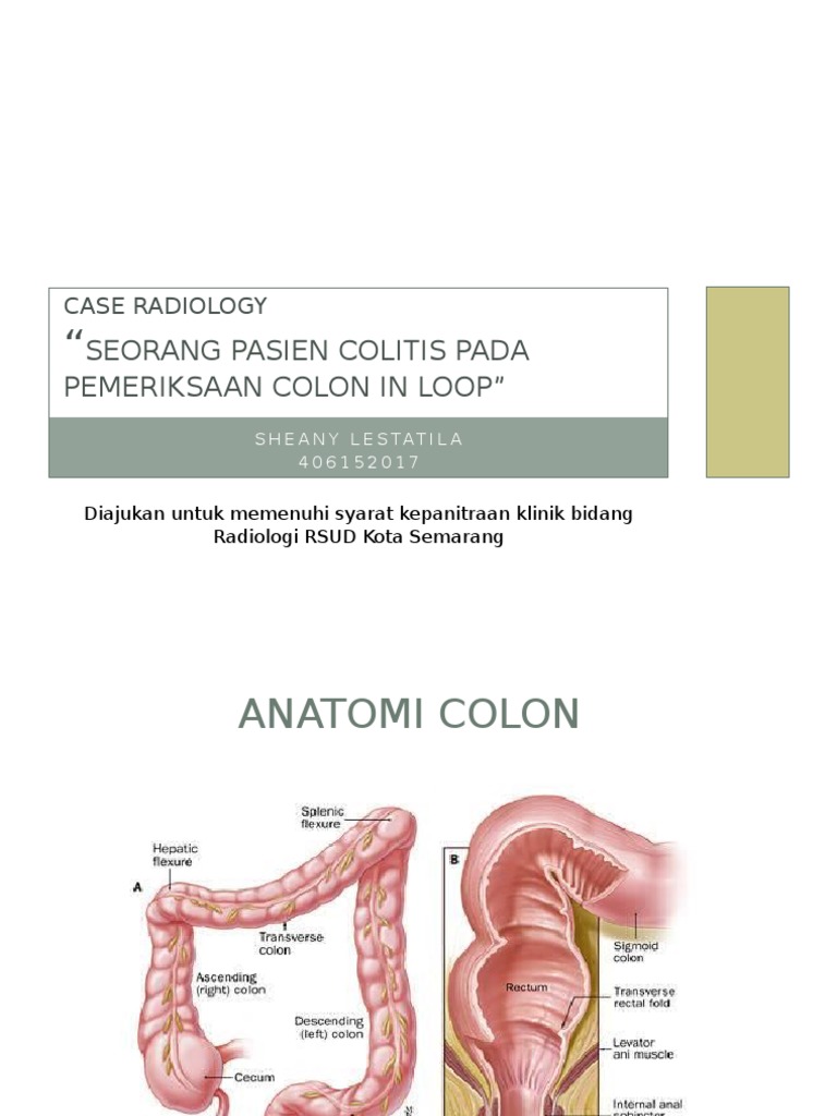 Kasus Seorang Penderita Colitis pada Pemeriksaan Colon in Loop | PDF