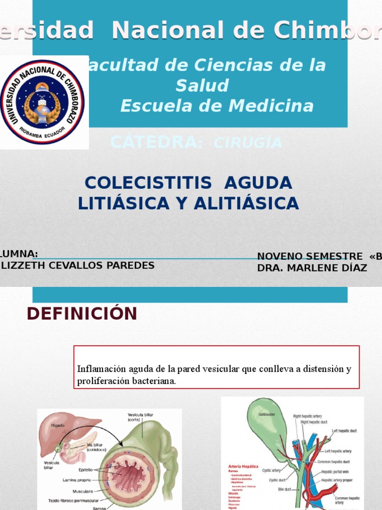 Colecistitis Aguda Litiásica Y Alitiasica Pdf Vesícula Biliar