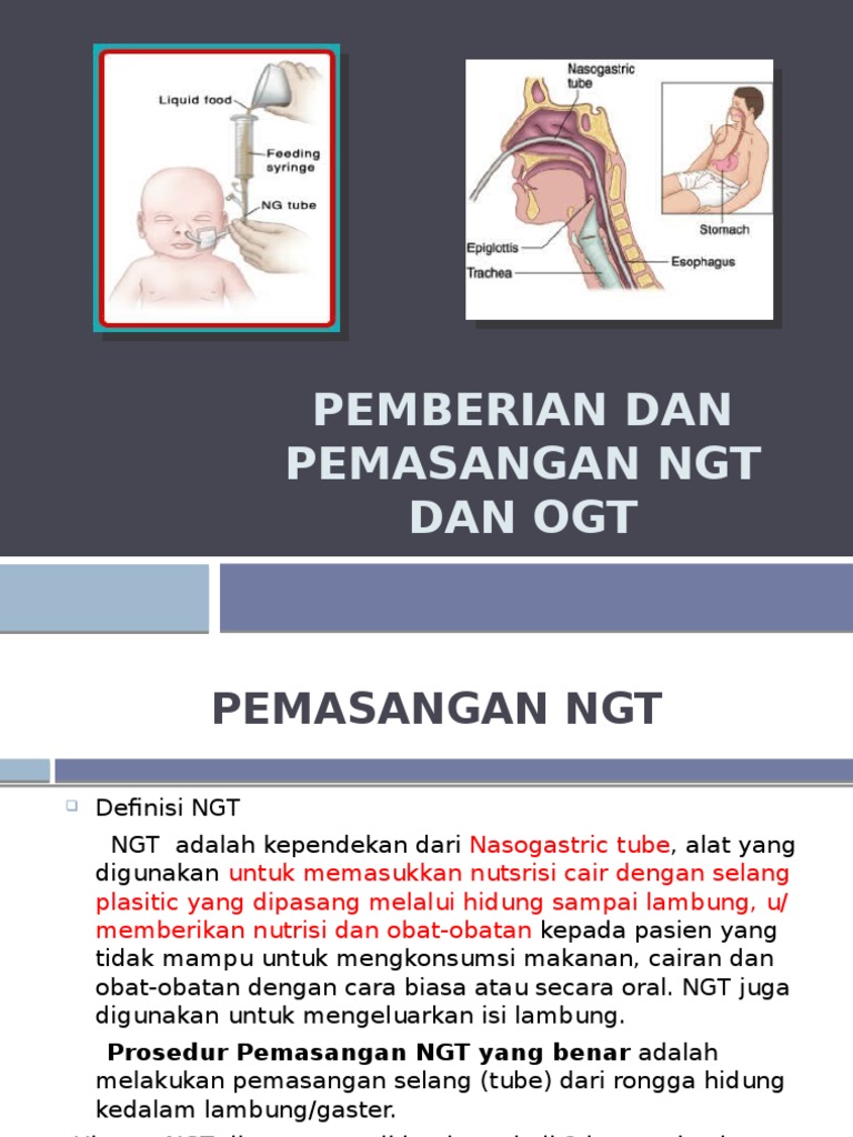 Ogt Dan NGT | PDF