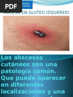 Bupirop 0 5 Pesado X 24 4 ML Ampoulepack | PDF | Terapia intravenosa ...