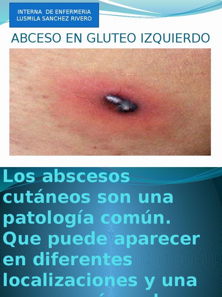 Abceso en Gluteo Diapositivas Luzmila Sanchez Rivero | PDF | Rtt ...