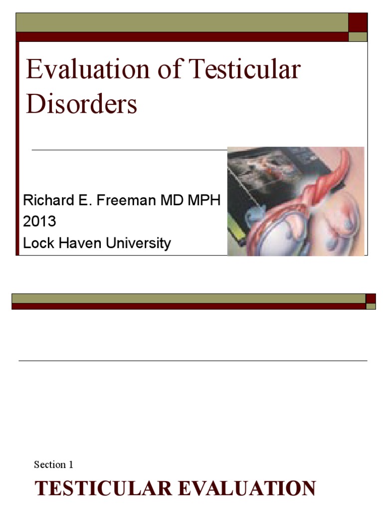 Testicular Disorders Pdf Health Sciences Medical Specialties