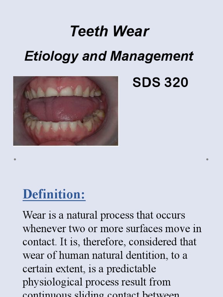Tooth Wear: Causes and Management | PDF