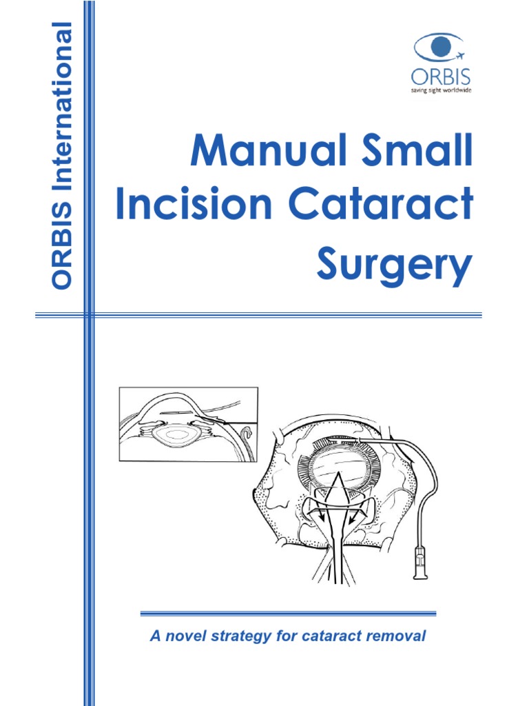 Manual Small Incision Cataract Surgery: A novel strategy for cataract ...