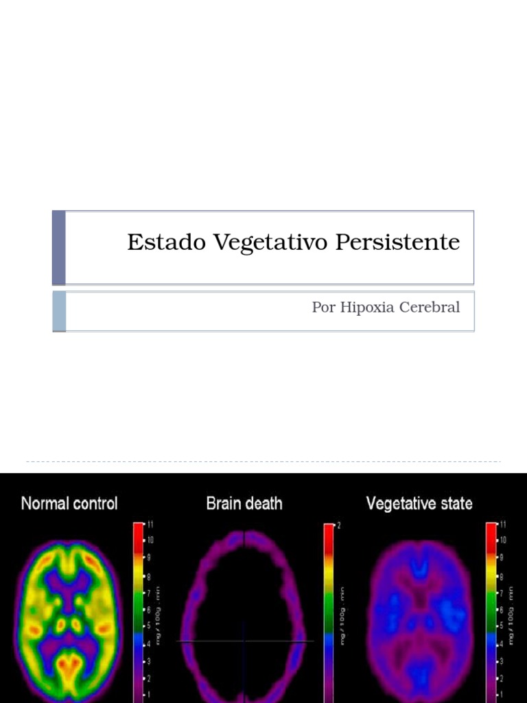 Estado Vegetativo Persistente | PDF | Hipoxia (médica) | Coma