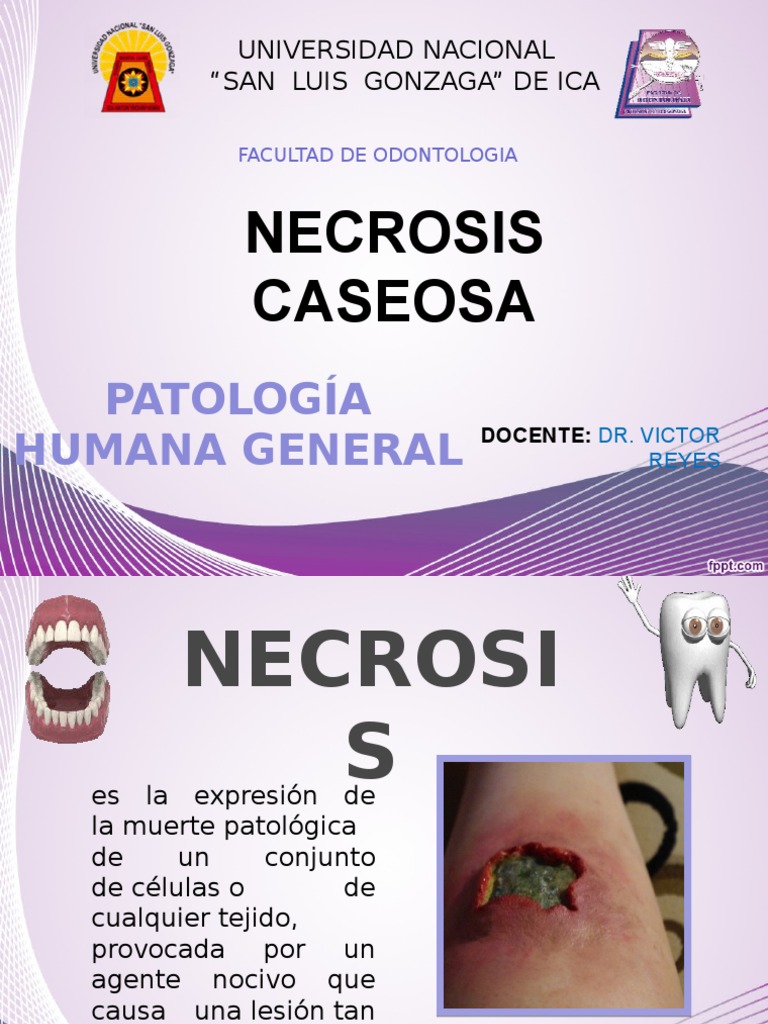 Necrosis Caseosa Pato | PDF | Tuberculosis | Medicina CLINICA