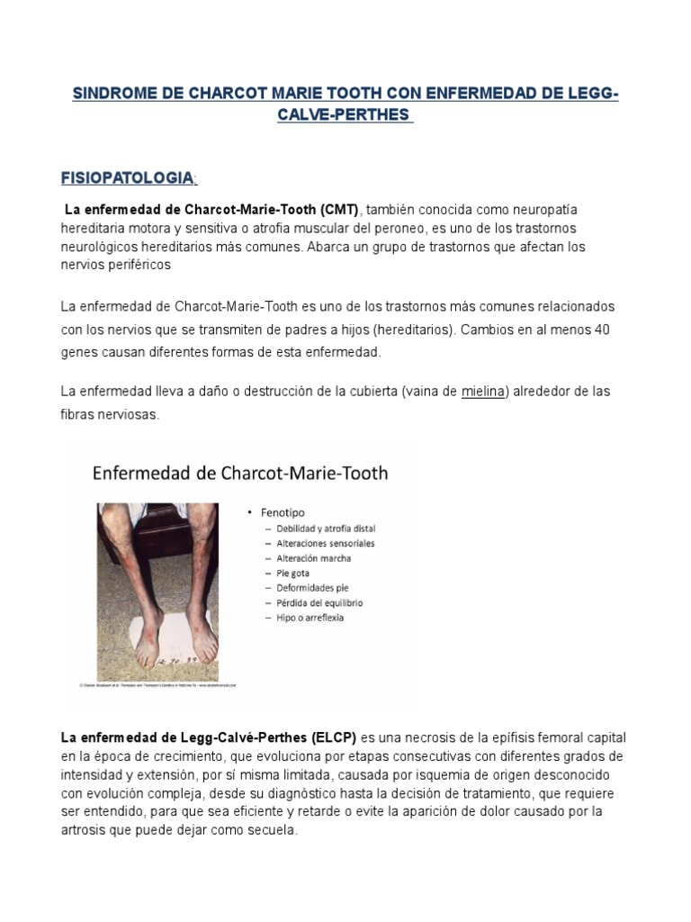 Sindrome de Charcot Marie Tooth Con Enfermedad de Legg | PDF | Pie ...