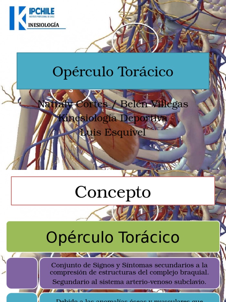 Síndrome del Opérculo Torácico | PDF | Tórax | Dolor