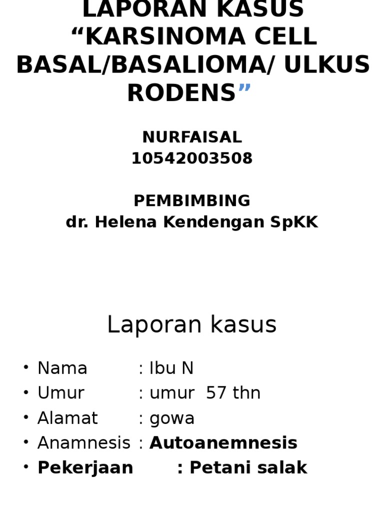LAPORAN KASUS Basalioma Print | PDF