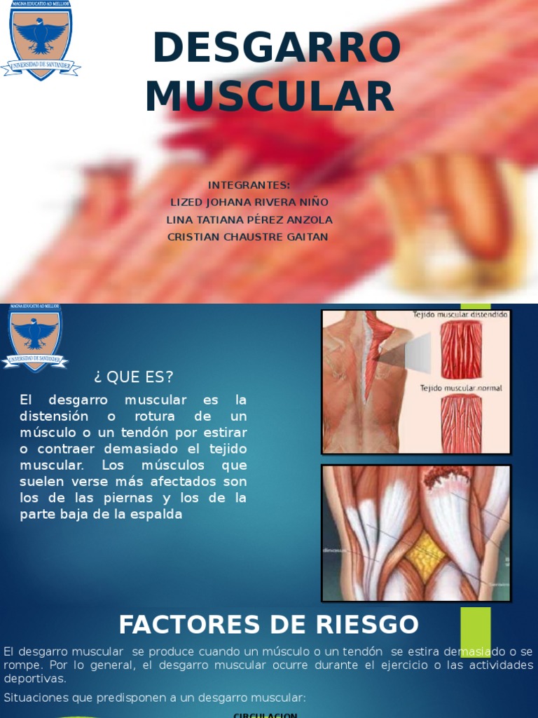 Desgarro Muscular | PDF