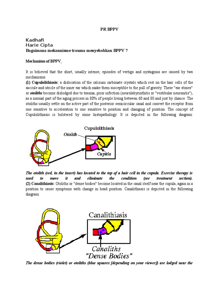 PR BPPV Kadhaf Harie Cipta Bagaimana Mekannisme Trauma Menyebabkan BPPV ...