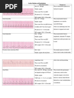 Pac PJC PVC | PDF | Cardiac Electrophysiology | Cardiac Arrhythmia