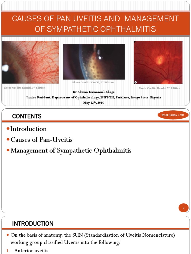 Pan Uveitis (Causes and MGT of Sympathetic Ophthalmitis) | Diseases Of ...