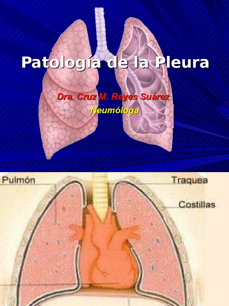 Patologias de Pleura dr. jimenez | Neumología | Sistema respiratorio