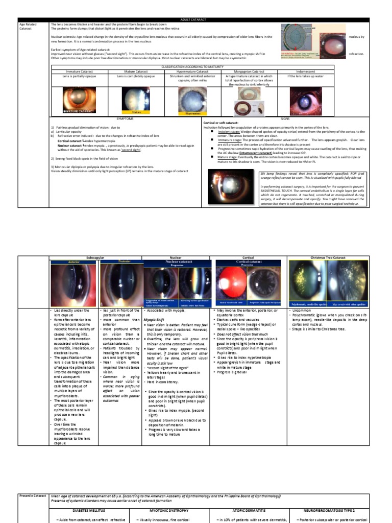 Adult Cataract: Cortical or Soft Cataract | PDF | Cataract | Glaucoma