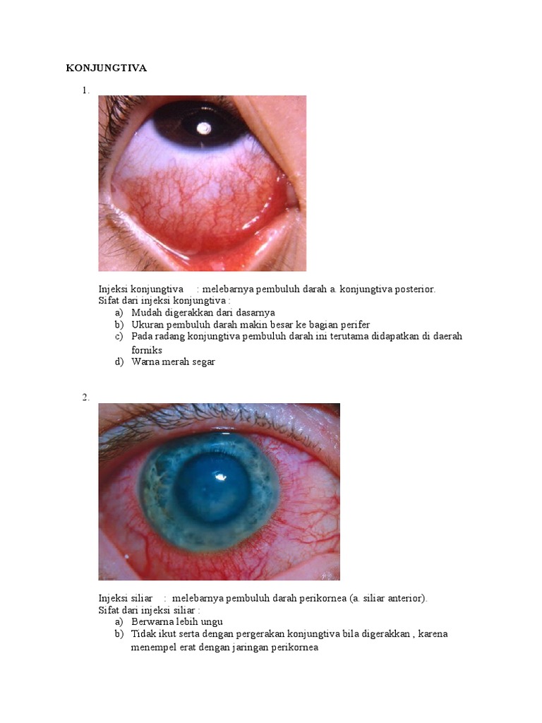 Terminologi Mata | PDF