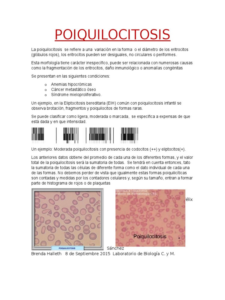 Poiquilocitosis: Variación Eritrocitaria | PDF