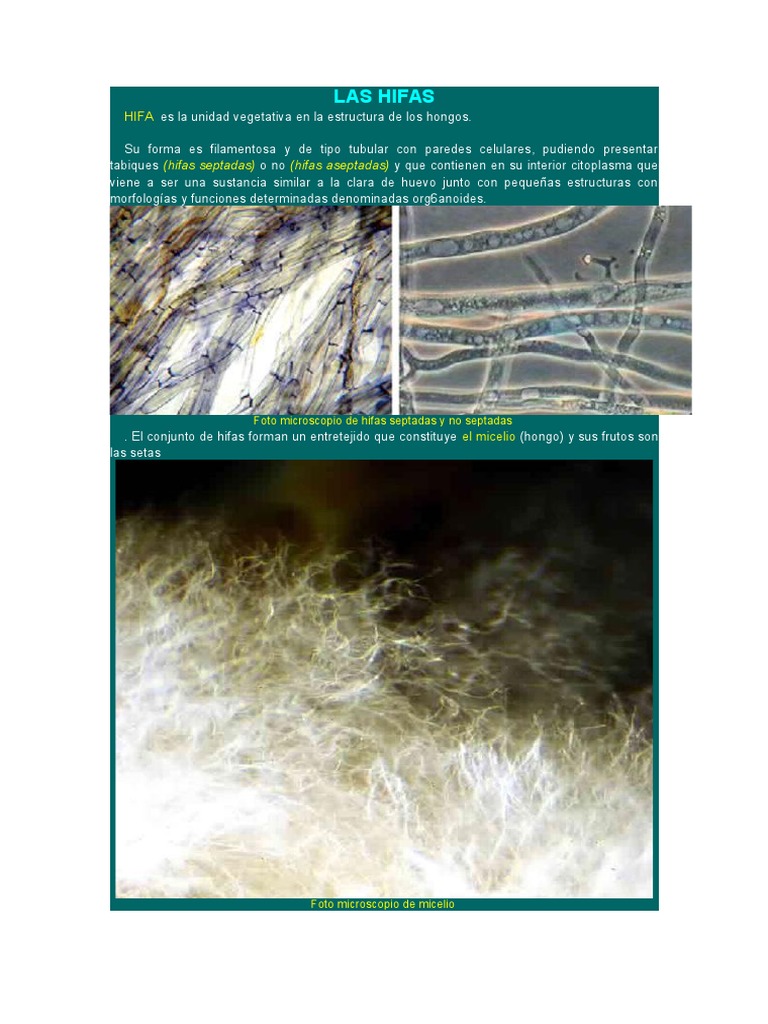 LAS HIFAS | Hongo | Ciencias de la tierra y de la vida